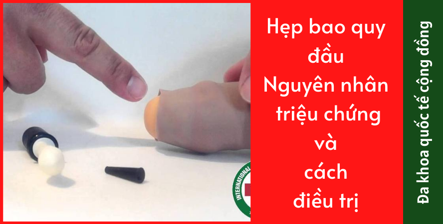 Hẹp Bao Quy đầu Nguyên Nhân Triệu Chứng Và Cách điều Trị