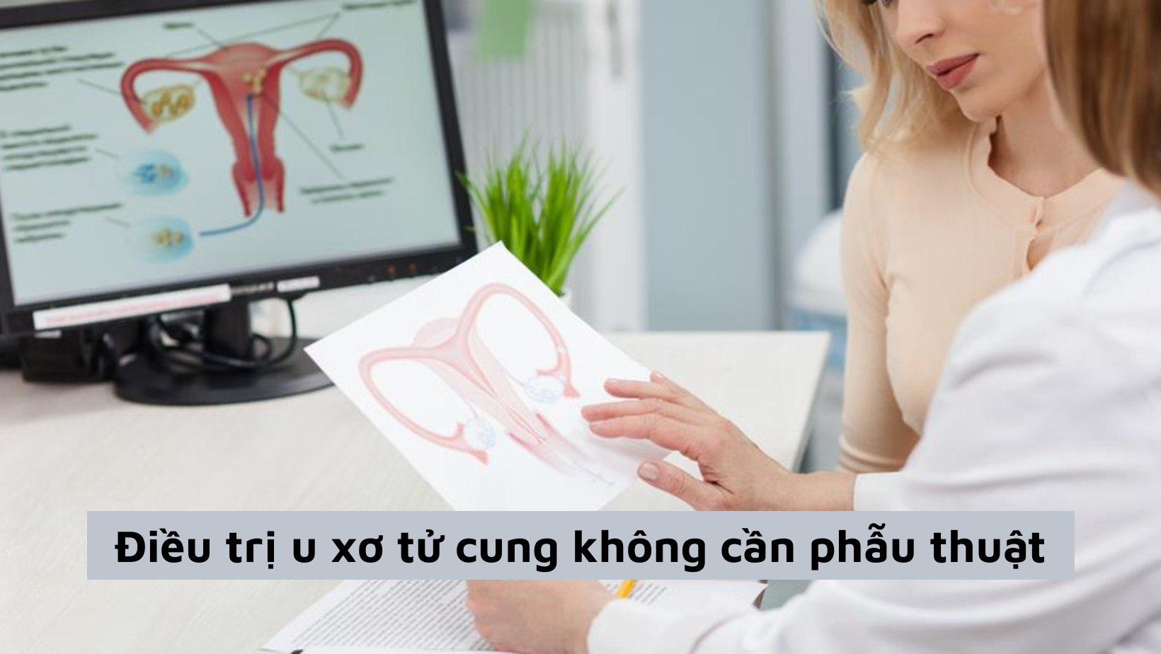Tổng hợp phương pháp điều trị u xơ tử cung không cần phẫu thuật