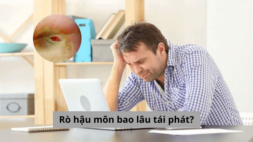 Rò hậu môn bao lâu tái phát? Nguyên nhân và cách phòng ngừa?